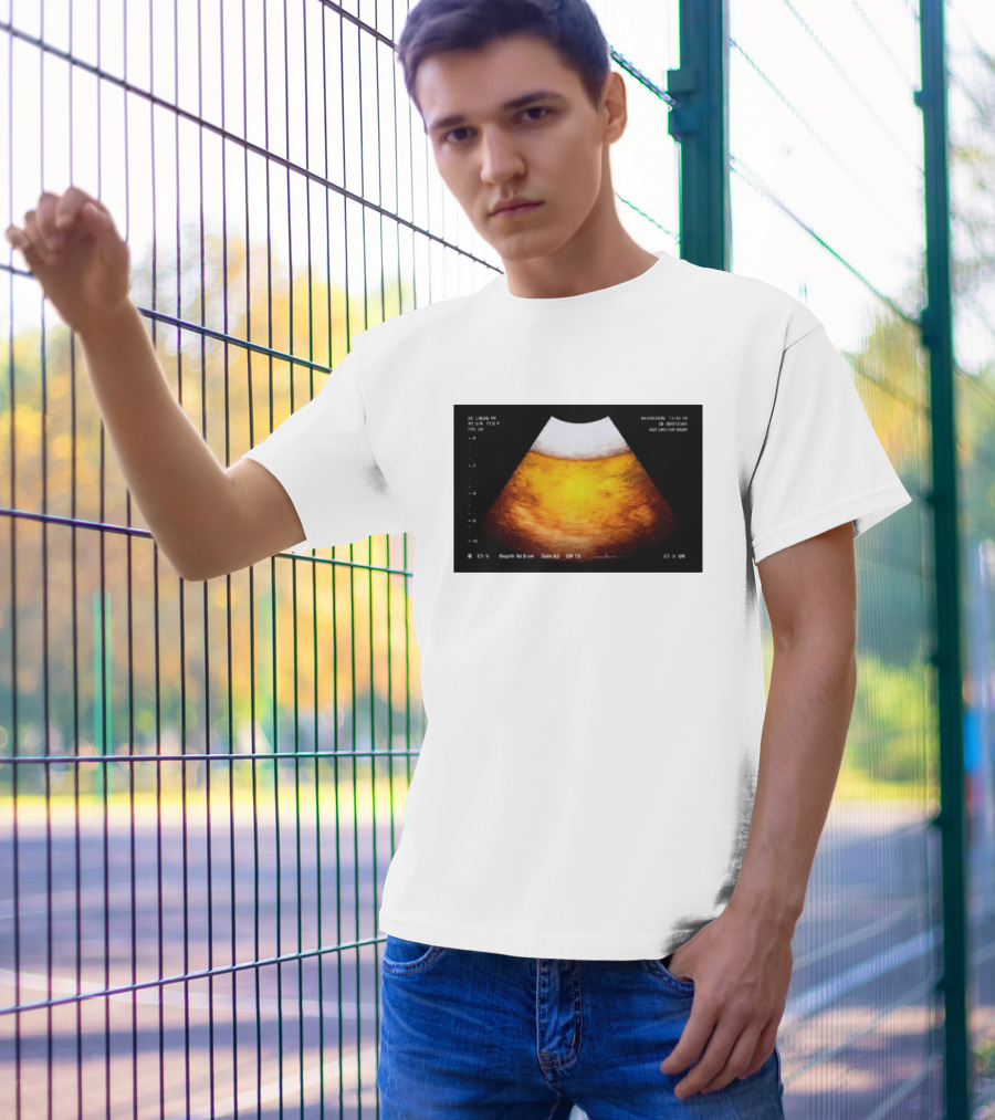 Beer Ultrasound Image Not Safe For Liver T-Shirt