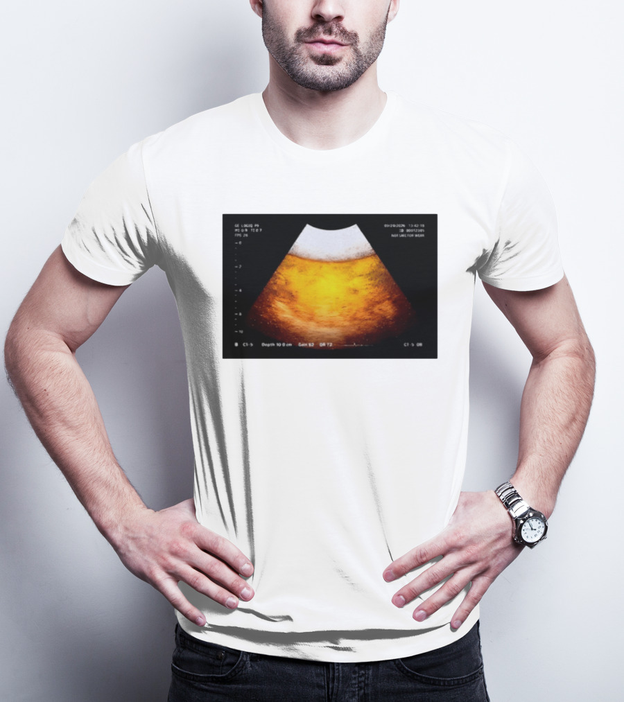 Beer Ultrasound Image Not Safe For Liver T-Shirt