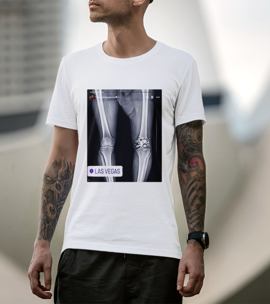 Conor McGregor X Ray Broken Knee Las Vegas T-Shirt