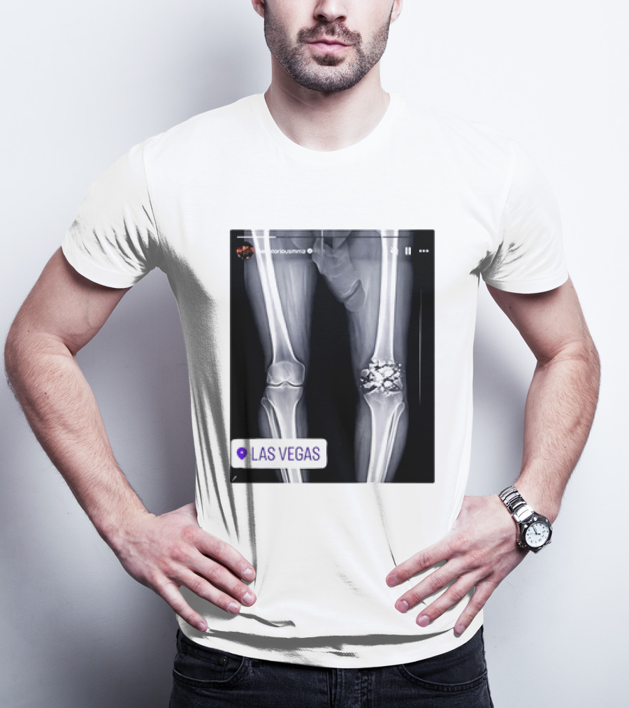 Conor McGregor X Ray Broken Knee Las Vegas T-Shirt